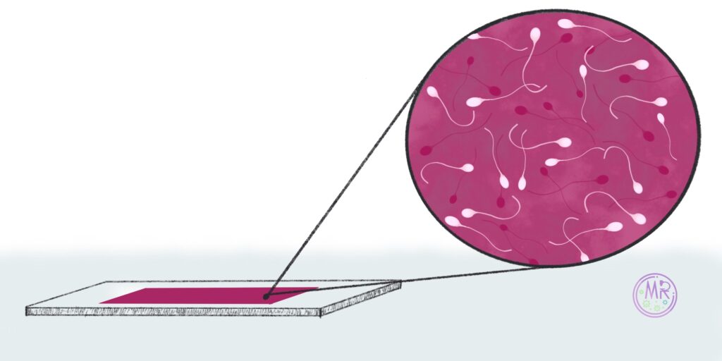 La tinción de Gram - El Laboratorio de Marrodmir