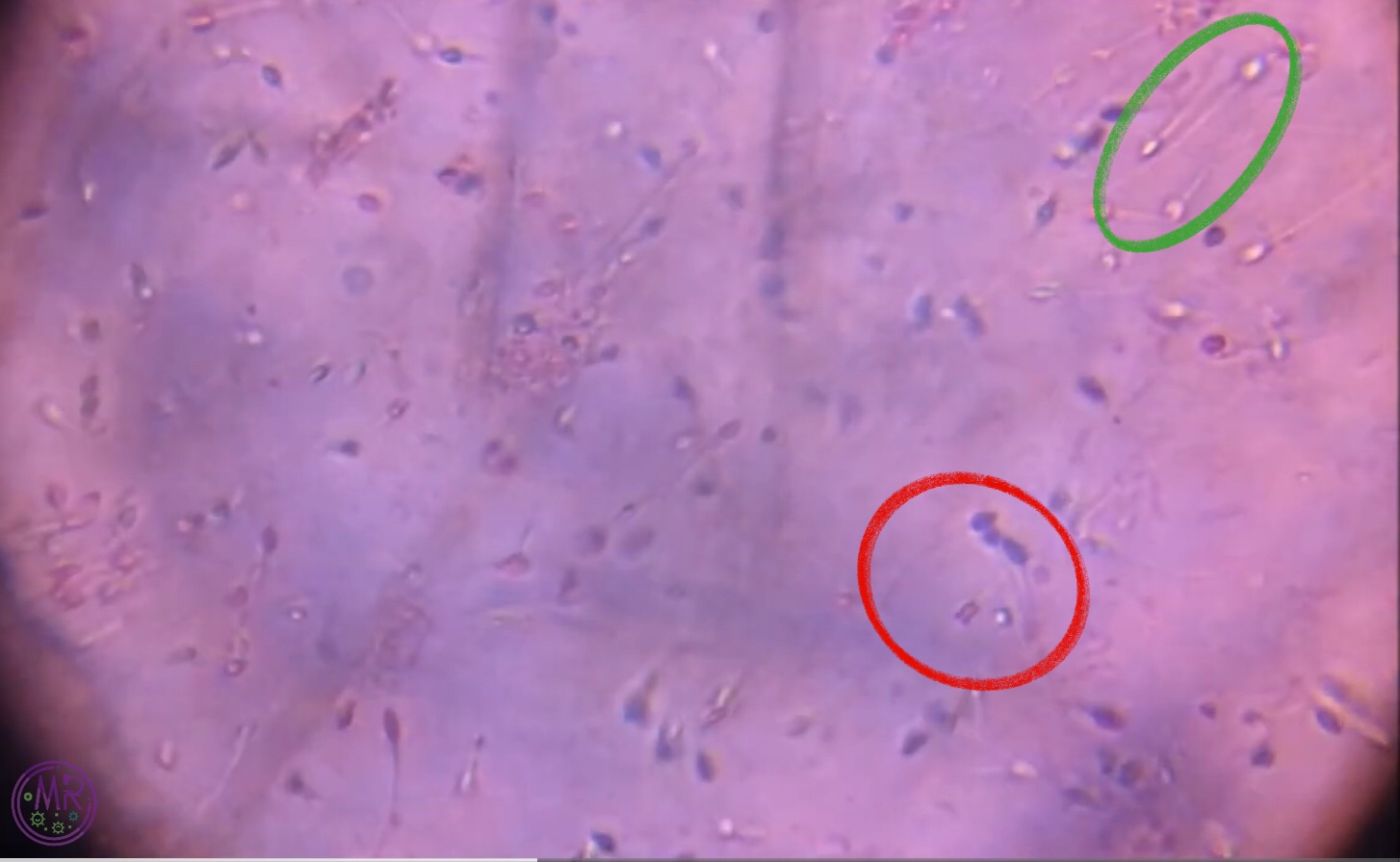 Estudio de vitalidad en muestras de semen - El Laboratorio de Marrodmir